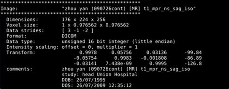 Beginner Connectome Pipeline Mrtrix3 Fsl And Freesurfer Mrtrix3 Community
