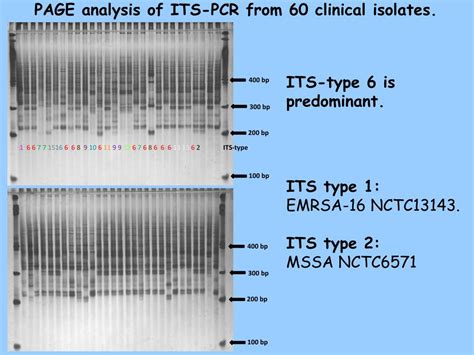 Ppt Rapid And Sensitive Detection Of Mrsa By Pcr Based Methods In The Environment And Hospital