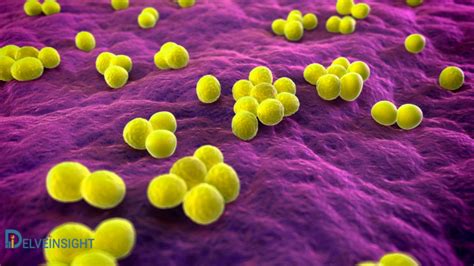 Fighting Deadly Infections Staphylococcus Aureus Bacteremia Pipeline Insight 2025