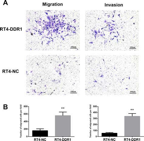 effect of the overexpression of ddr1 on bc cell migration and invasion