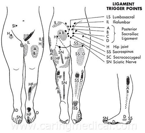 Prolotherapy For Pelvic Groin Pain Caring Medical Pain Care Pain Medical Knowledge