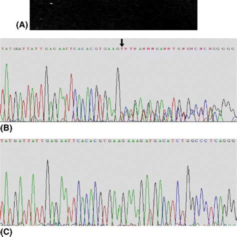 Mutation Detected By Dgge And Sequence Confirmation Of 3729delainstct Download Scientific