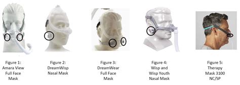 Philips Pap Masks With Magnetic Closures Recalled Va News