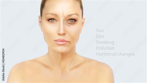 Ageing Skin Internal And External Causes Of Skin Aging Signs Of Skin