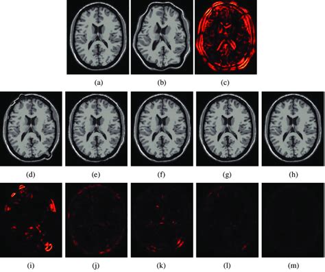 Visualization Of Registration Accuracy Results Using A Heatmap For A Download Scientific