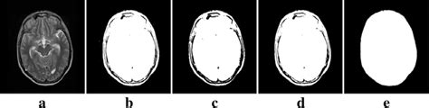 An Example Of Mr Slice Segmentation A Original B Segmented C Eroded