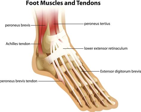 Strained Leg Tendon