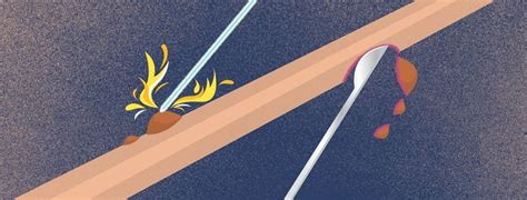 Excision Vesus Ablation For Surgical Treatment Of Endometriosis