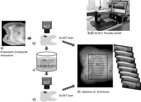 Assessment Of Defects At Tooth Self Adhering Flowable Composite Interface Using Swept Source