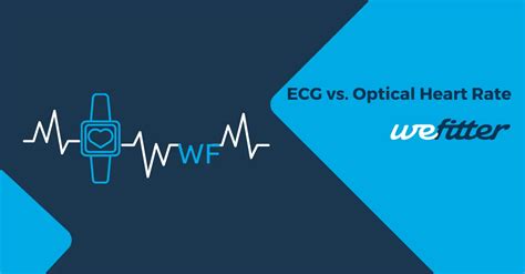 Ecg Vs Optical Heart Rate Blog Wefitter