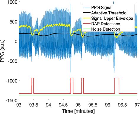 Figure 3 From Detection And Classification Of Sleep Apnea And Hypopnea Using Ppg And Spo 2