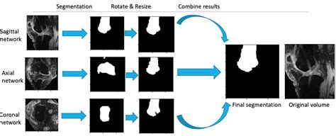 Github Brendan0403bonessegmentation Bones Segmentation By Deep Learning