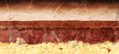 Thin Skin Stock Image P710 0446 Science Photo Library