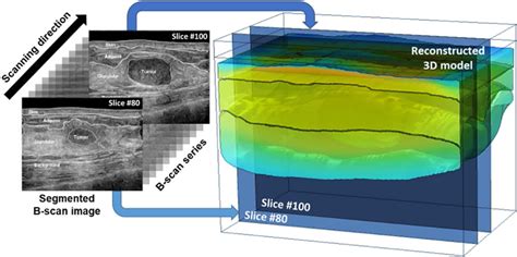Figure 2 From A Three Dimensional Modeling Method For Quantitative Photoacoustic Breast Imaging