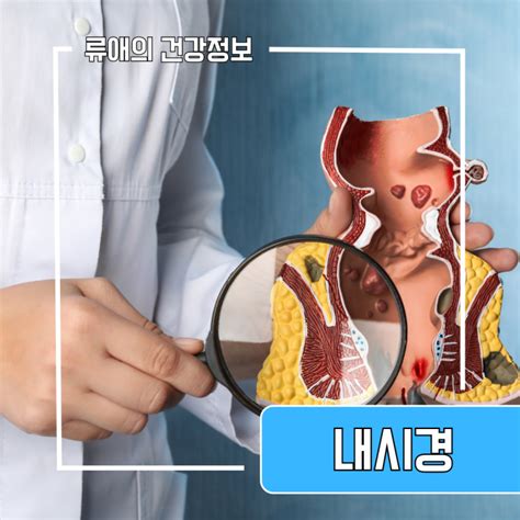 수면 대장내시경 용종제거 비수면 대장내시경 후 식사 및 약 복용 네이버 블로그