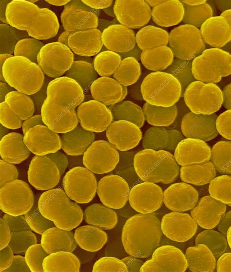 Methylococcus Capsulatus Sem Stock Image C032 2167 Science Photo Library