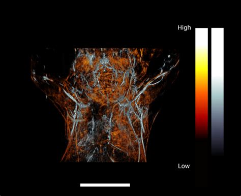 Neuroimaging Photosound