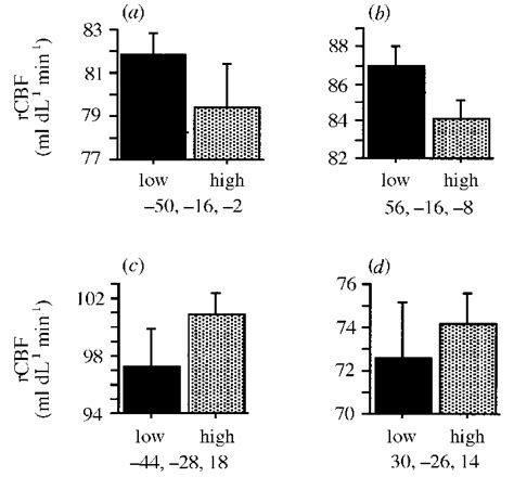 Graphical Displays Of The Mean Rcbf Values In Ml Dl 71 Min 71 At The