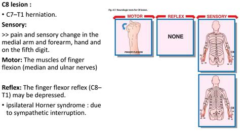 Spinal Nerves And Roots Pptx