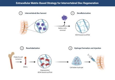 Extracellular Matrix Based Strategy For Intervertebral Disc