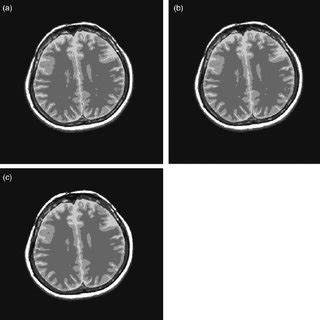 PDF Fuzzy C Means Clustering With Spatial Information For Image Segmentation Computerized
