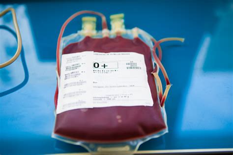 Transfusion Thresholds For Patients Receiving Ecmo Transfusion News