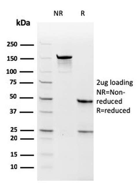 Thymidylate Synthase Recombinant Monoclonal Antibody Rtyms 1884