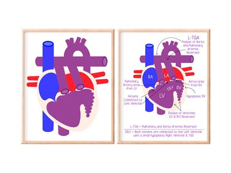 Custom Color Chd Heart Illustration Diagram Digital File Etsy