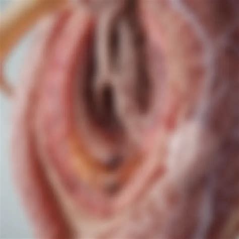 Comprehensive Insights Into Multiple Myoma Uteri