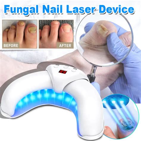 Nail Fungus Laser Treatment Device Repair Toenail Fingernail Fungus