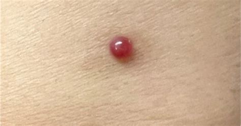 Journal Of The Dermatology Nurses Association On Linkedin In