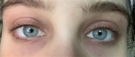 Light Skin Around Eyes At Tracy Dibenedetto Blog