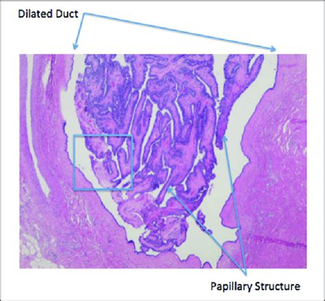 The Image Of Figure 1 Is Labeled Showing The Central Papillary Download Scientific Diagram