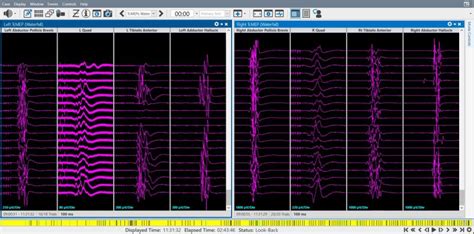 Syed Ahmed Uddin Imran Bsc Reegt Cnim On Linkedin Cadwell Brilliance Quality Ionm