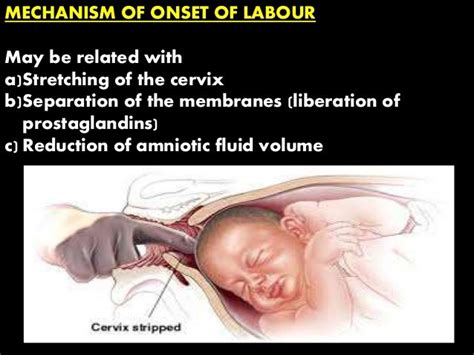 Induction Of Labour Ppt