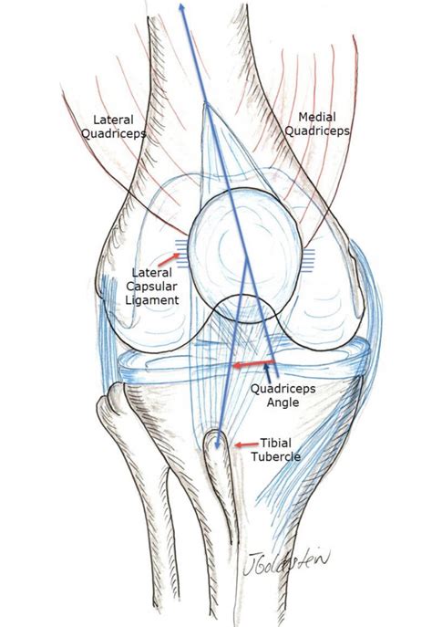 Patellar Maltracking And Patellar Realignment Anteromedializationtibial Tubercle Osteotomy