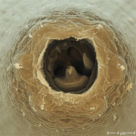 Nematode Teeth Consist Of Chitin