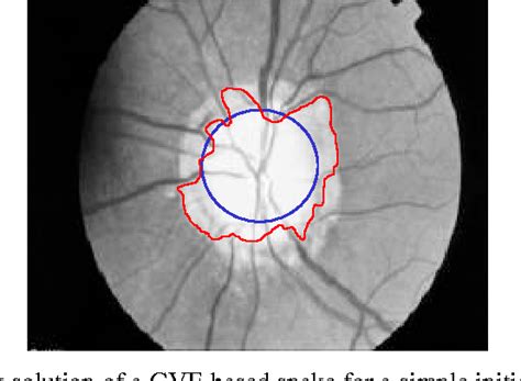 Figure 1 From Identification Of The Optic Disk Boundary In Retinal Images Using Active Contours
