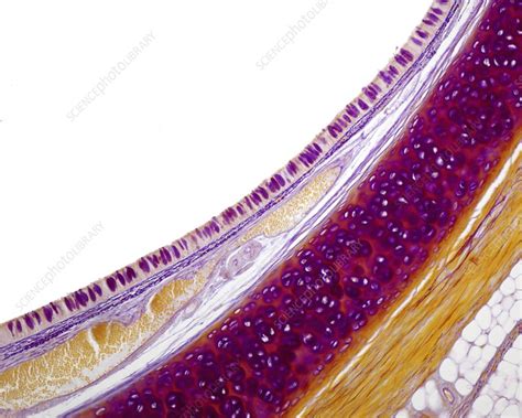 Trachea And Thyroid Gland Light Micrograph Stock Image C038 5541 Science Photo Library