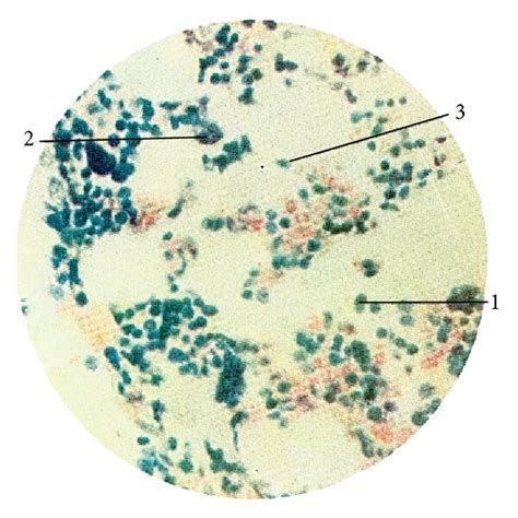 Internal Primo Node Giemsa Stain 1 Hemocytoblast 2 Megakaryocyte
