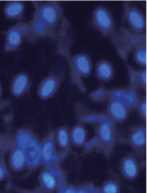 A Double Fluorescent Staining Kit Was Used For The Detection Of The