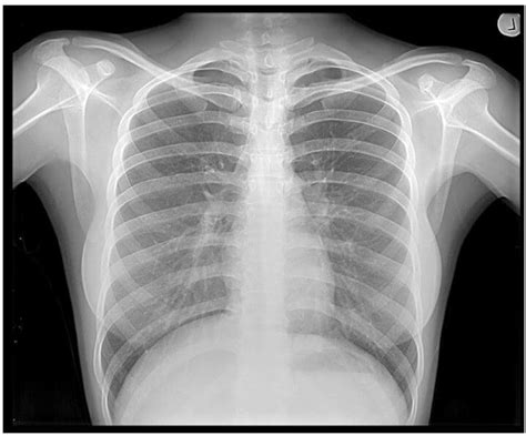 X Rays Examples