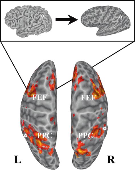 Fronto Parietal Attention Network Download Scientific Diagram