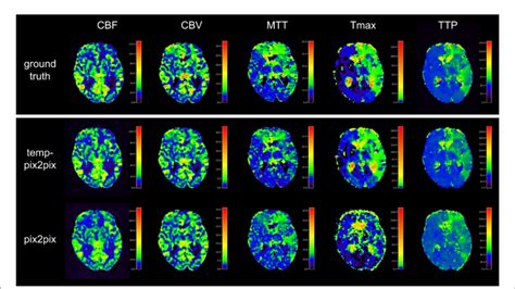 FIGURE Synthesized Perfusion Parameter Maps Middle Bottom Rows