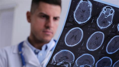 Multiple Sclerosis Treatment Options Effective Treatments And Care