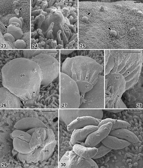 Scanning Electron Micrographs Of Cryptosporidium Fragile Sp N Fig