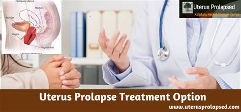 Uterus Prolapse Treatment Options