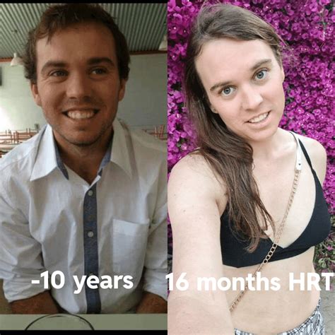 10 Year Challenge No Makeup No Surgeries I Got Cute 🥰 Rtranstimelines