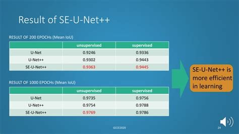 Transfer Learning Model For Image Segmentation By Integrating U Netplusplus And Se Block