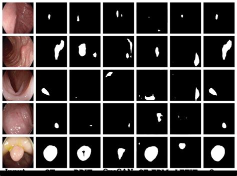 visualization of segmentation maps using different methods download